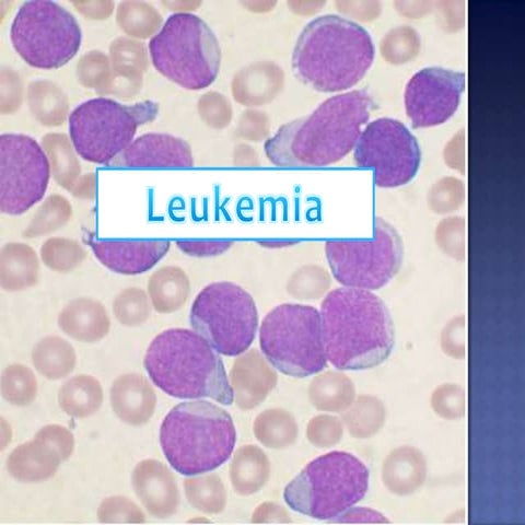 Leukemia | PPT
