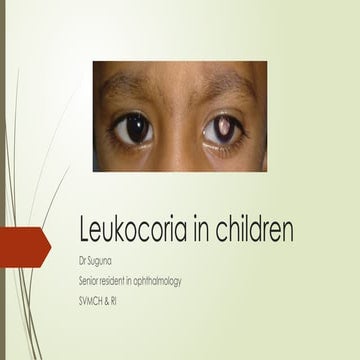 Leukocoria in children in ophthalmology. | PPTX