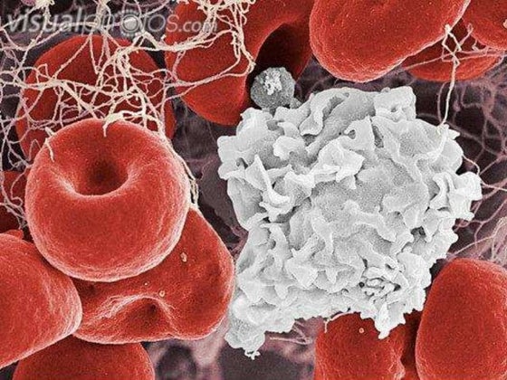 Wbc & platelets anomalies | PPTX | Blood Disorders | Diseases and ...