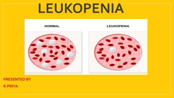 Cellulitis | PPTX | Skin and Dermatology | Diseases and Conditions