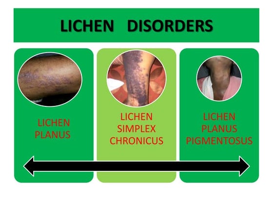 herbals in dentistry | PPTX