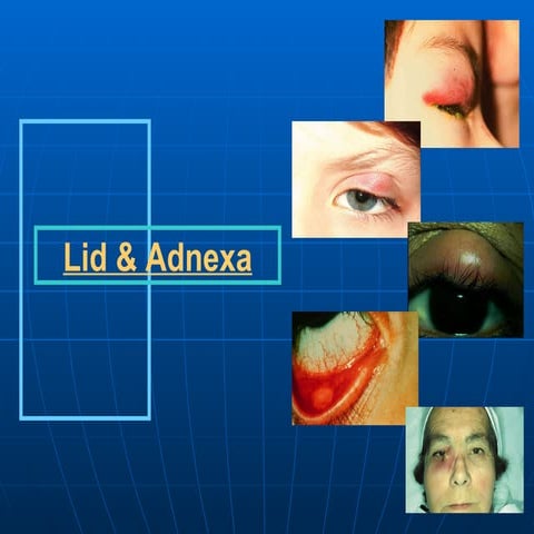 Lid & adnexa | PPT