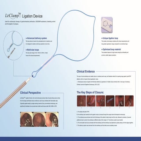 ligation-device-2.pdf