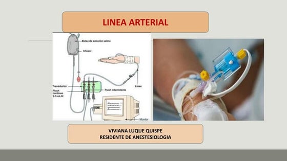 Linea arterial | PPT