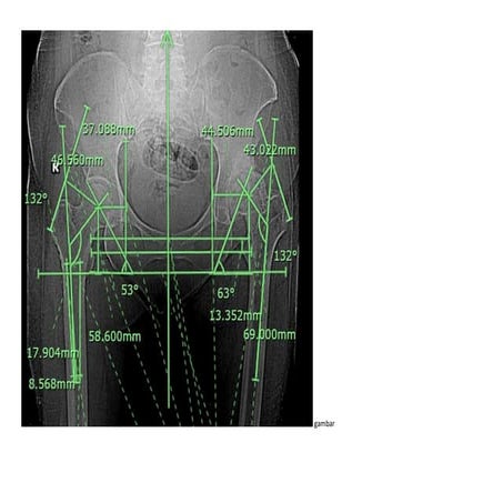 line of height center the coverability.docx