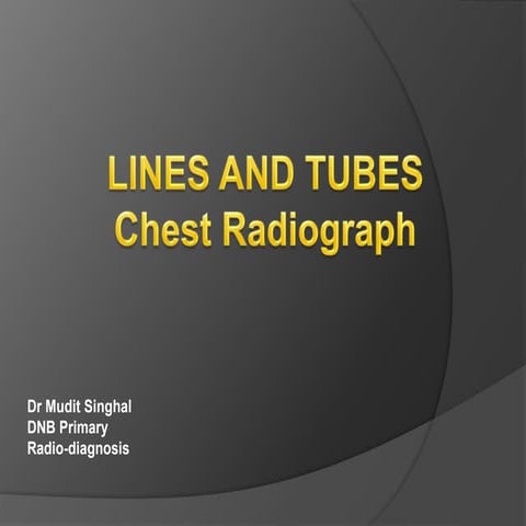 Lines and tubes in xray | PPTX