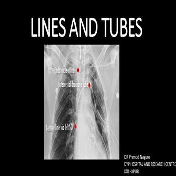 CHEST XRAY TUBES.pptx,,,,,,,,,,,,,,,,,,, | PPTX