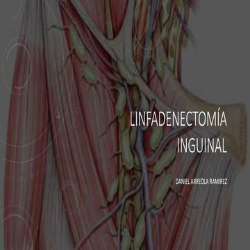 Anatomía De La Disección Del Ganglio Inguinal Técnica Del