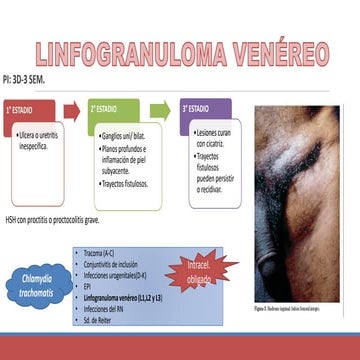 LINFOGRANULOMA VENEREO resumen.pptx