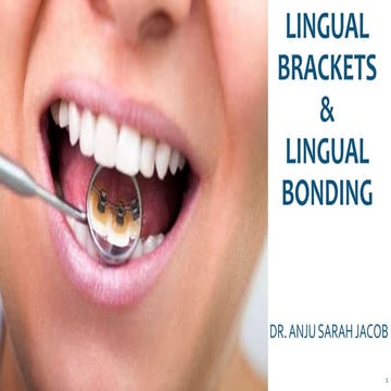 Lingual Orthodontics (Lingual Brackets & Lingual Bonding) | PPTX