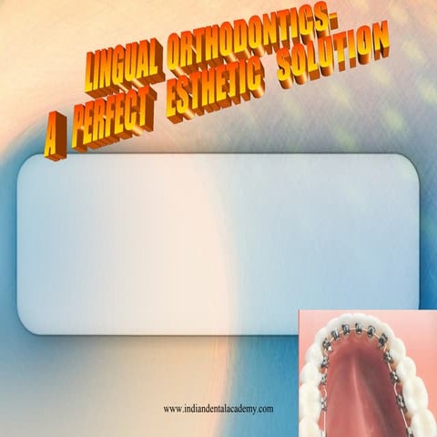 Self ligating brackets | PPT