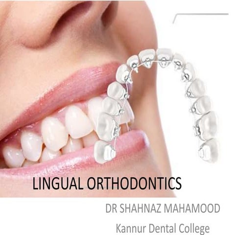 Self ligating brackets | PPT