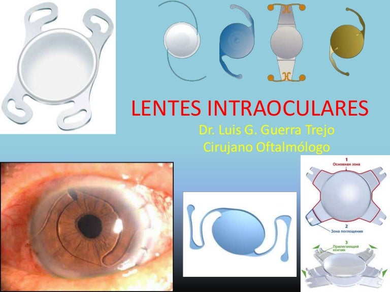 Lentes Intraoculares