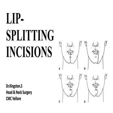 Lip splitting incisions | PPT