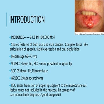 Lip cancer ( updated ) | PPTX