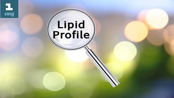 Lipid profile test ppt | PPTX