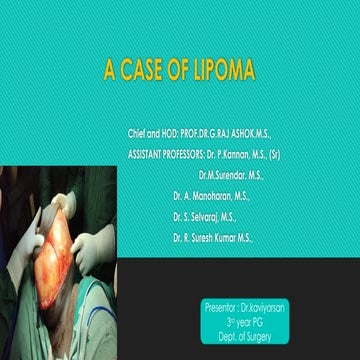 lipoma large abdominal wall- casestudy final.pptx