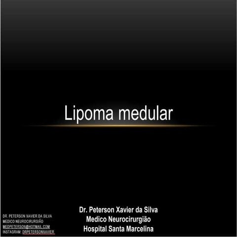 Lipoma Medular | PPTX
