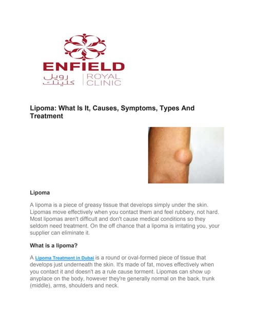 What Is Lipoma Know Its Causes, Symptoms And Treatment.pptx