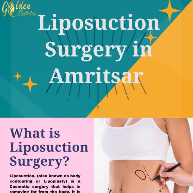 Liposuction Surgery in Amritsar | Golden Aesthetics | PDF | Cosmetic ...