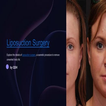 Liposuction-Surgery quttainah Dubai.pptx