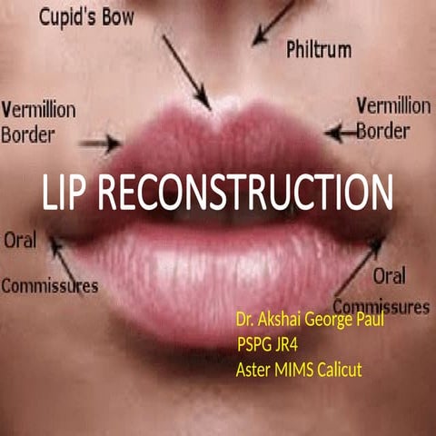 Lip Reconstruction Dr.AGP.pptx