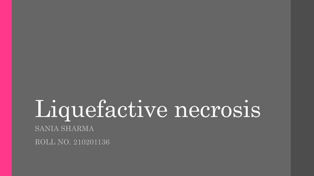 Forensic medicene,putrefaction | PPTX