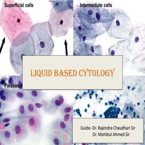 Liquid based cytology | PPTX
