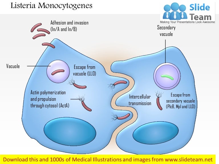 Listeria monocytogenes medical images for power point