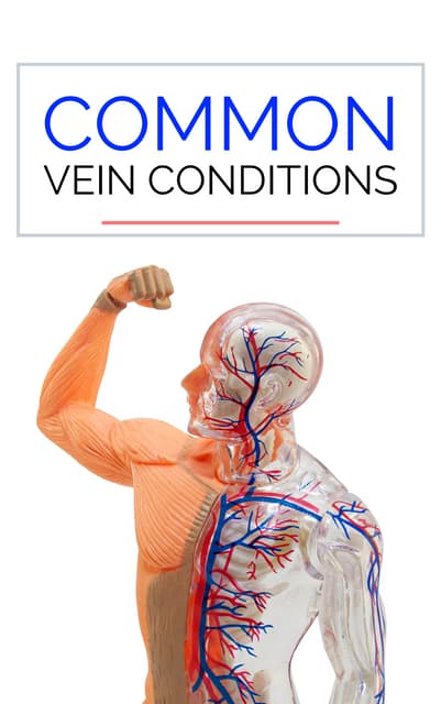 Symptoms of Spider Veins on Ankles.pdf