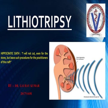 Lithiotripsy | PPTX