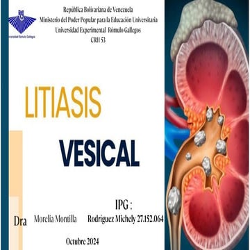 Litiasis Vesical o Cálculos Urinarios.pptx