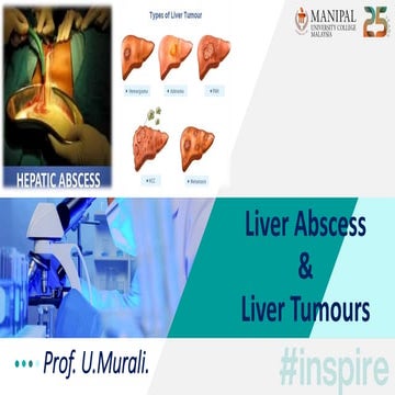 Liver - Surgical Anatomy, Abscess and Liver - Tumours | PDF