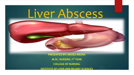 Liver abscess | PPTX | Infectious Diseases | Diseases and Conditions