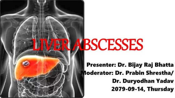 CAUSES OF liverabscess AND ITS MANAGEMENT | PPT