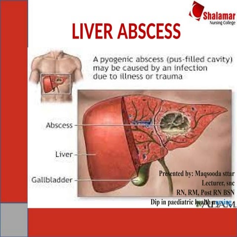 liver abscess.pptx nursing ppt 3rd years | PPTX
