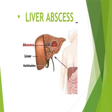 LIVER ABSCESS summary power point slides | PPTX