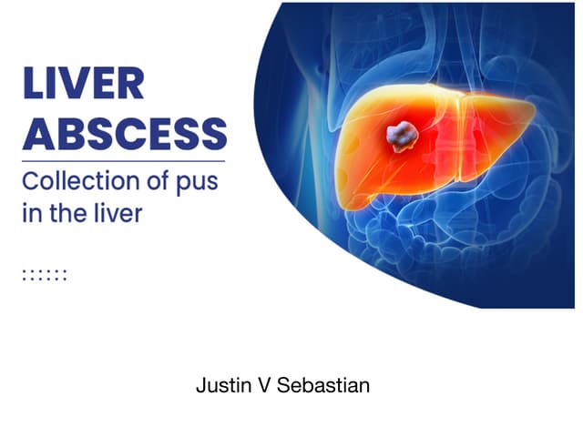 abcess.pptx surgery ppt management causes | PPTX