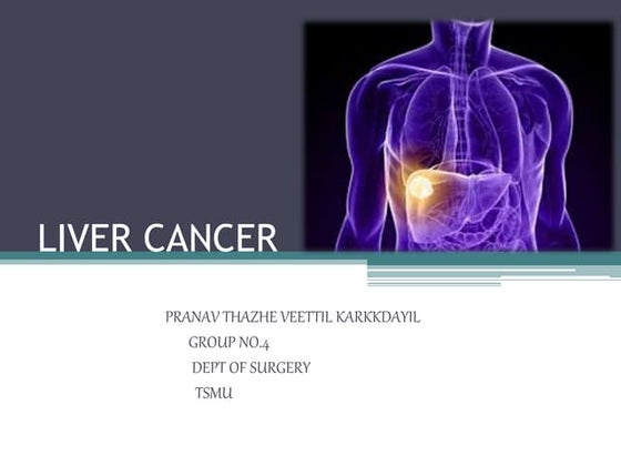 Liver cancer treatment in Delhi | PPT