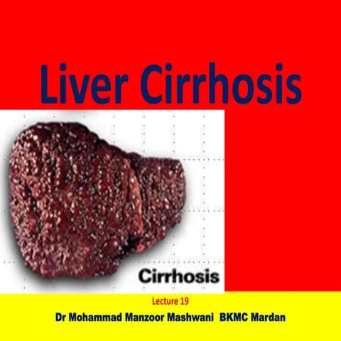 Liver cirrhosis for students n | PPTX