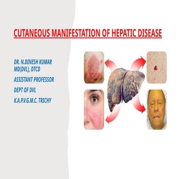 Cutaneous manifestation of liver disease.pptx