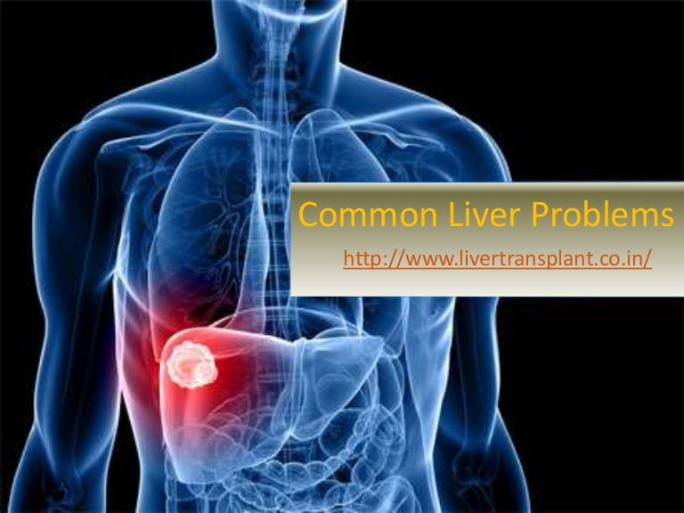 Common Liver Problems