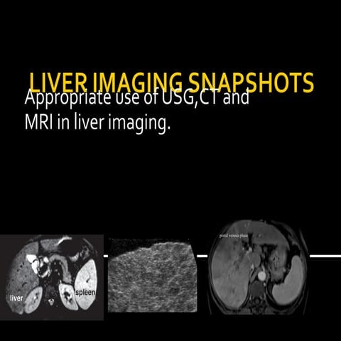 Liver imaging snapshots role of CT USG MRI in liver imaging. | PPT