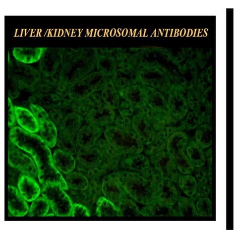 Liver kidney microsomal antibody | PPTX