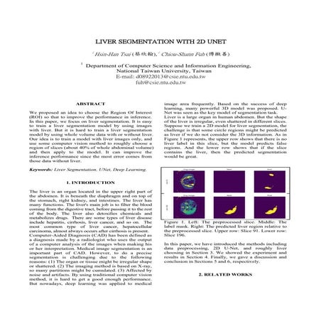 Liver Segmentationwith2du Net Pdf