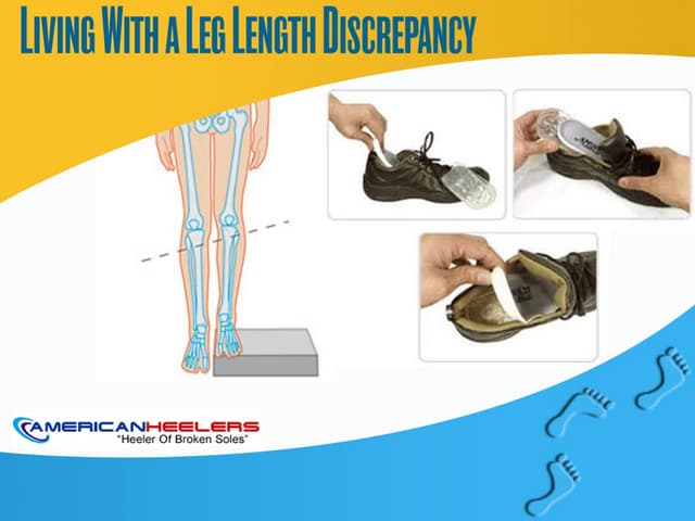 Shoes To Correct For A Leg Length Discrepancy – Sfostsee