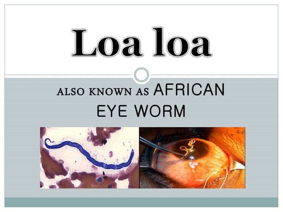 Classification of Microfilaria | DOCX | Infectious Diseases | Diseases ...