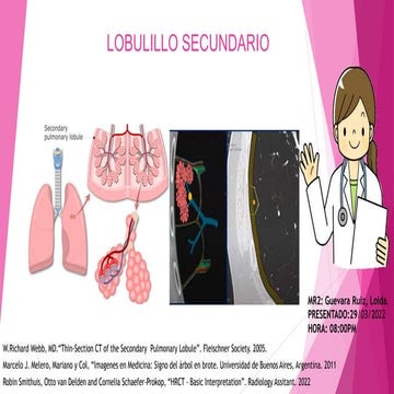 Fisiología (Lobulillo pulmonar secundario, espacio alveolar.pptx