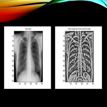 Local contrast enhancement on Chest X ray images | PPTX