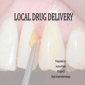 Local drug delivery | PPTX